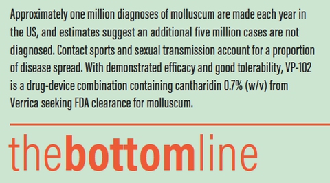 Molluscum: Challenges and a Promising Solution