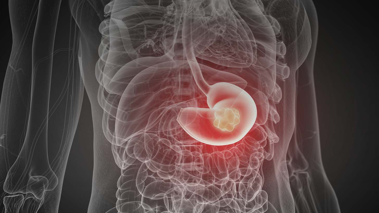 CME: Bringing Treatment Into Focus: Biomarker-Driven First-Line Therapy ...