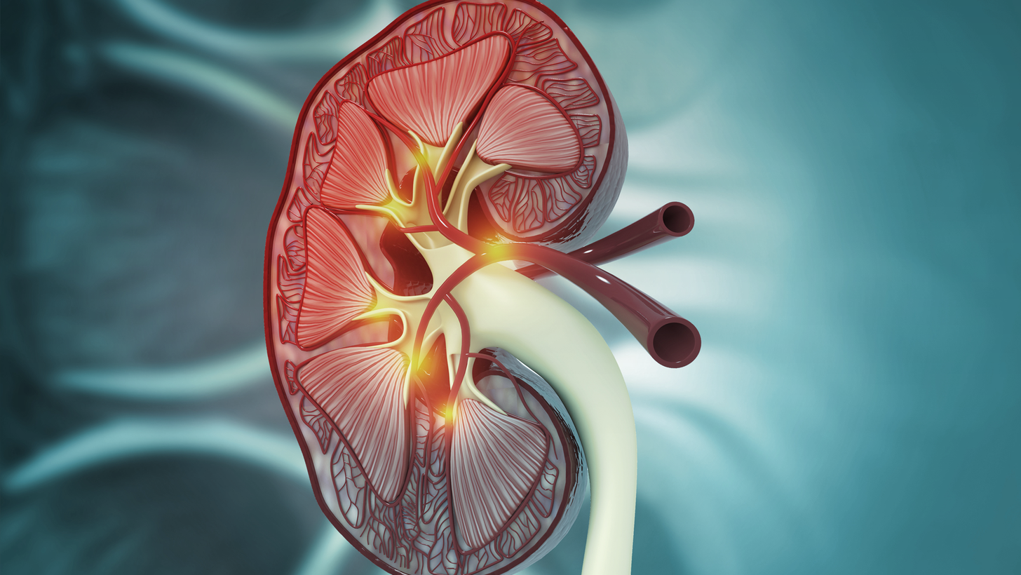 hyperphosphatemia, CKD, dialysis, tenapanor, NHE3 inhibitors