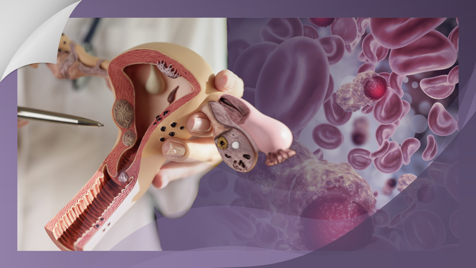 Oral Contraceptives and Endometrial Cancer