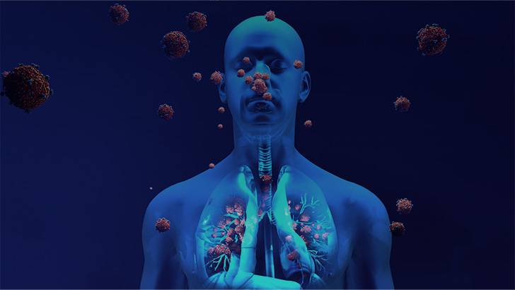 The Vicious Vortex: Key Mechanisms of Bronchiectasis
