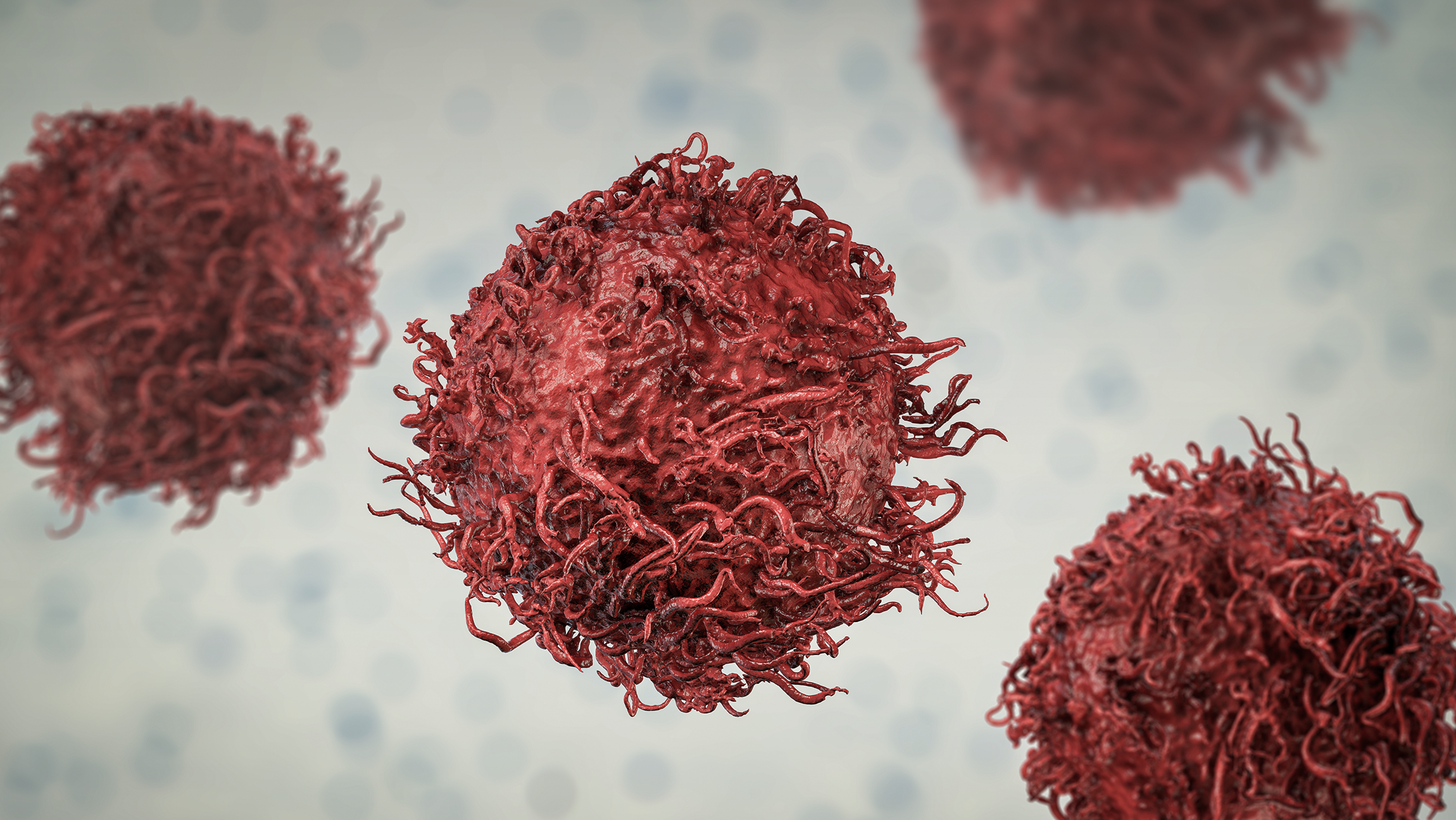 CME: Immunotherapy, gastric cancer, GEJ cancer, zolbetuximab