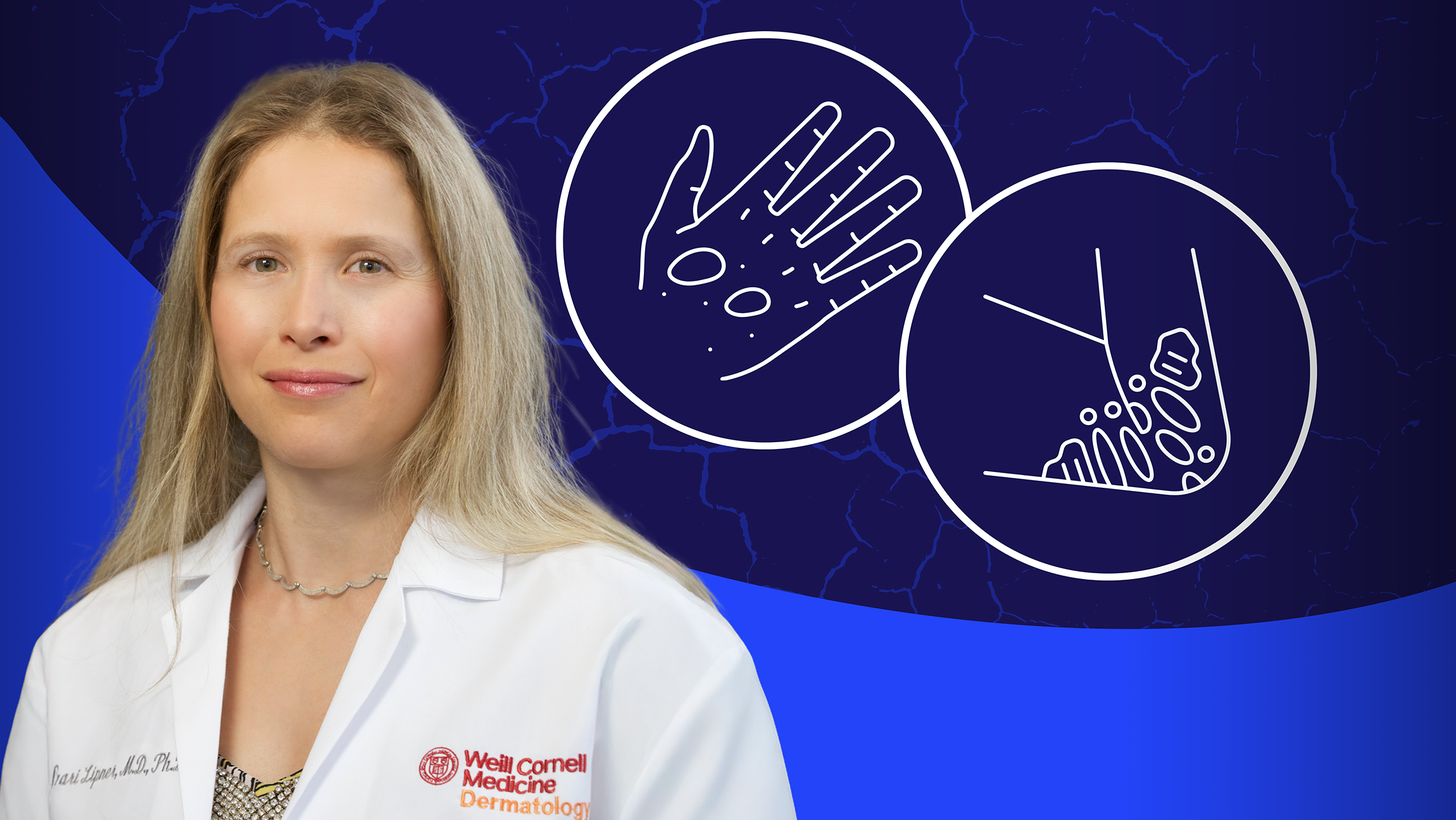 Nail Psoriasis: Evaluating Quality-of-Life Measures and Trea