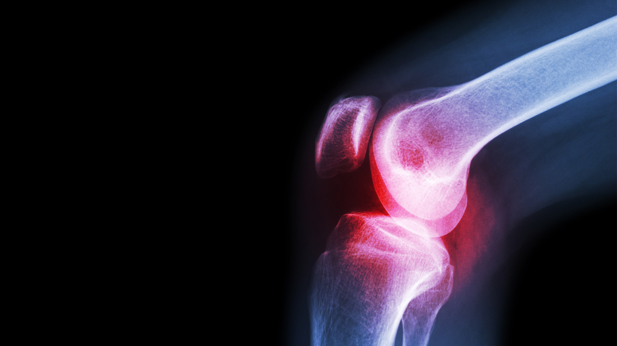 Rheumatology - ReachMD