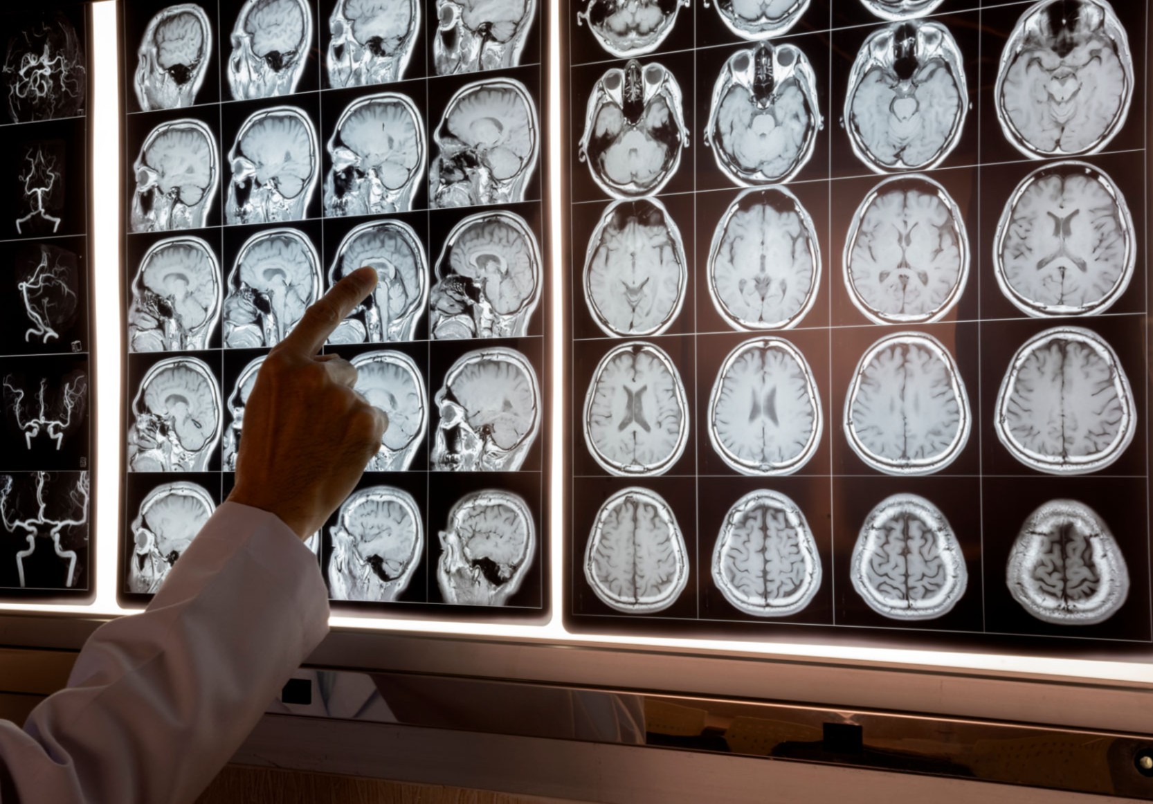 BrainSee Software Receives FDA Approval for Whole Brain Image Analysis ...