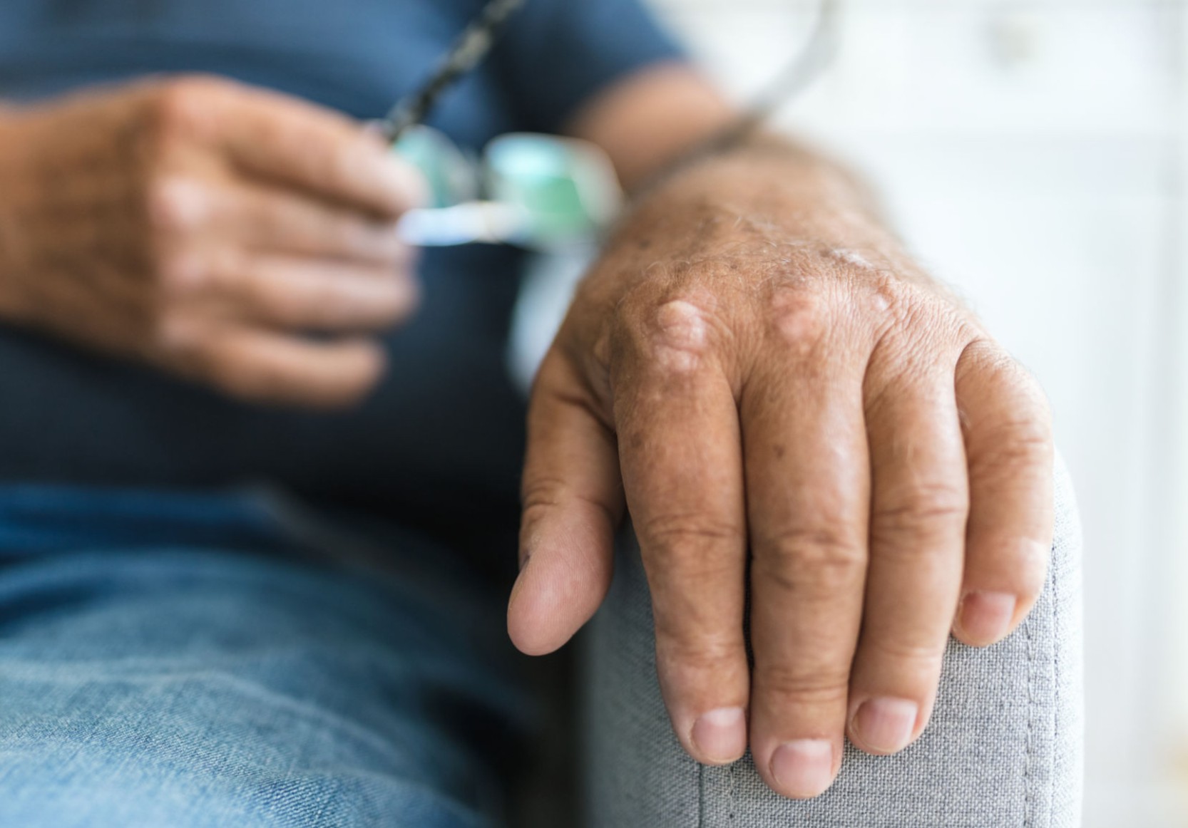 New Drug Bimzelx Shows Promise as a Treatment for Psoriatic Arthritis ...