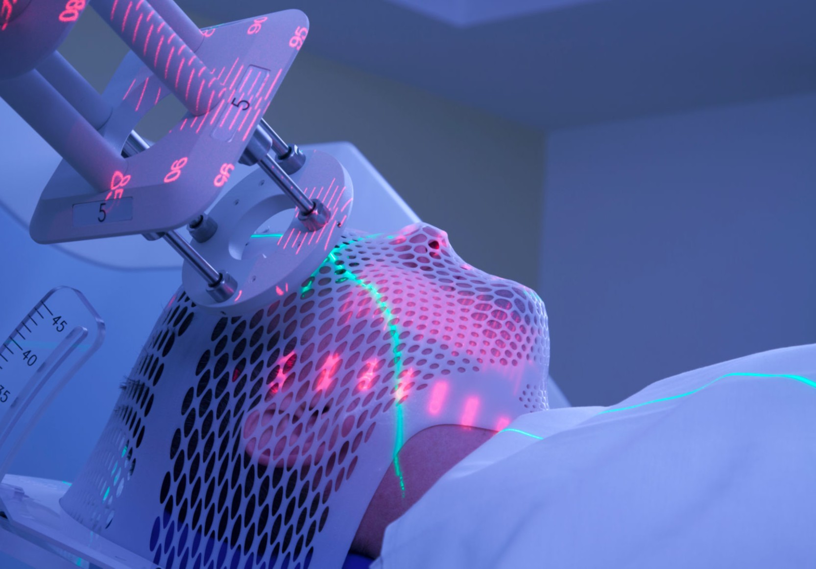 SRS With Immunotherapy Extends Survival in RCC with Brain Metastasis ...