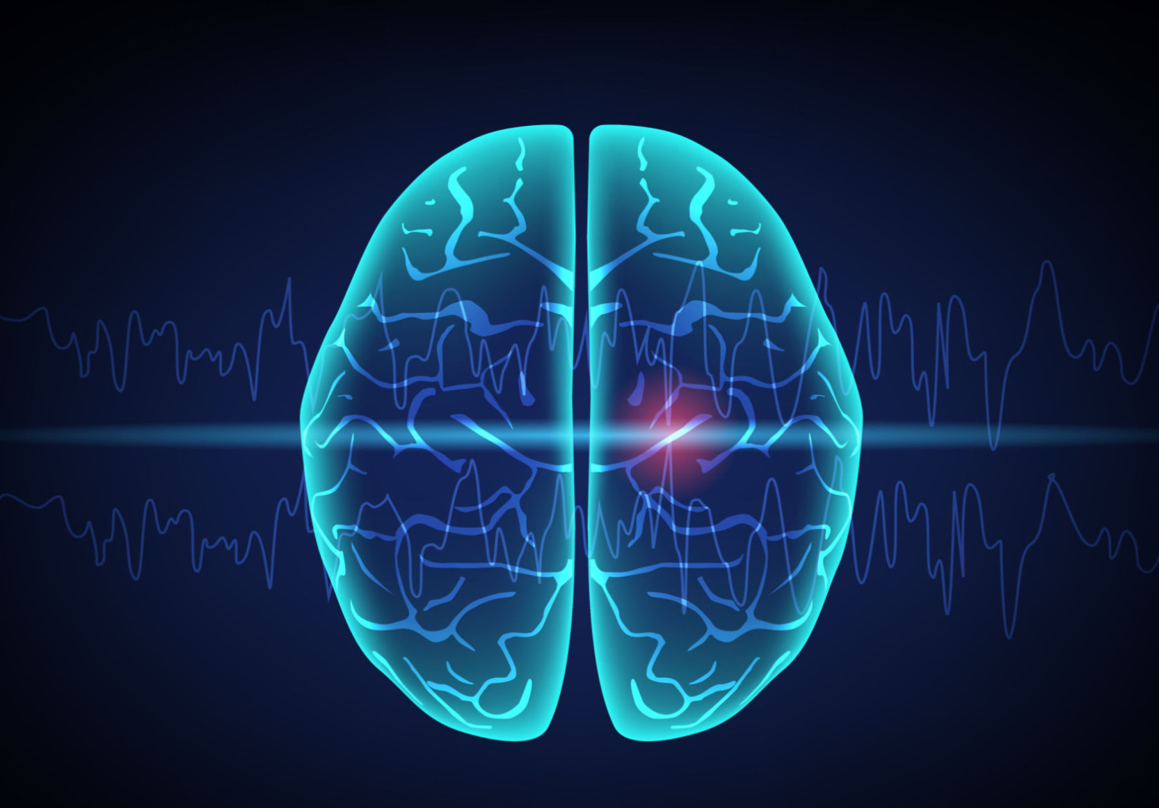 Study Assesses Seizure Risk from Stimulating Thalamus - Be part of the ... Study Assesses Seizure Risk from Stimulating Thalamus - Be part of the ...