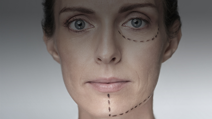 What factors have contributed to a rise in plastic surgery?