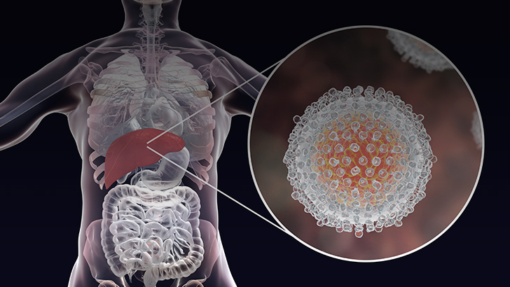 How We Can Help Patients Navigate the Hepatitis C Care Journey Medical ...