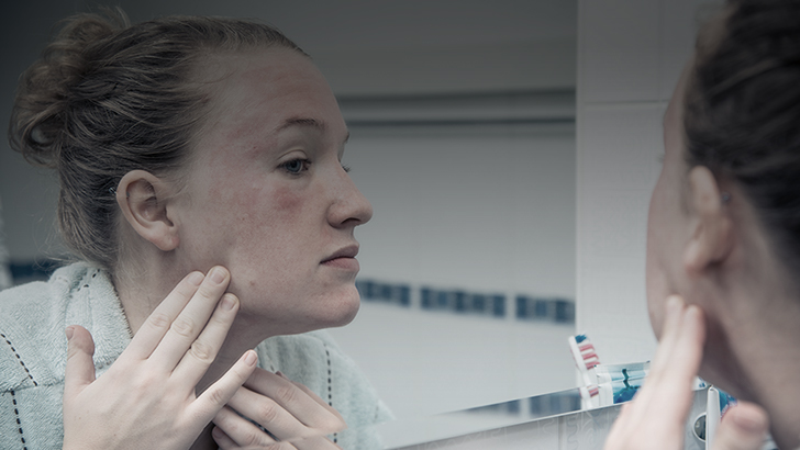 The Surprising Effects of Wildfire Smoke on the Skin