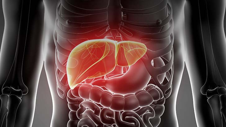 Progress in Primary Biliary Cholangitis Care: A Look at Management ...