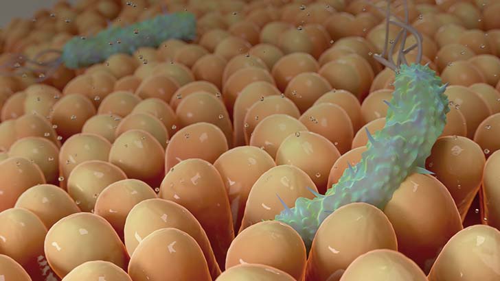 Breaking Down Our Approach to Small Intestinal Bacterial Overgrowth ...