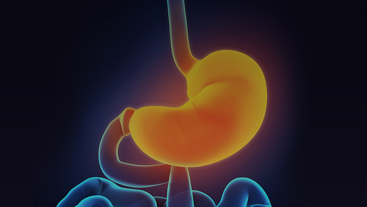 A Look at the Treatment Landscape for Gastroparesis Medical Education ...