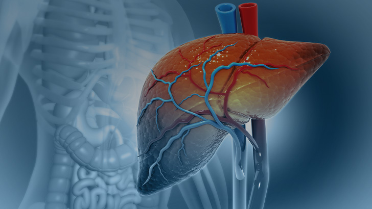 New Guidelines for TIPS in Portal Hypertension