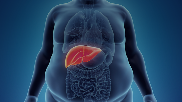 CME; resmetirom, NAFLD, MAESTRO-NASH, lanifibranor