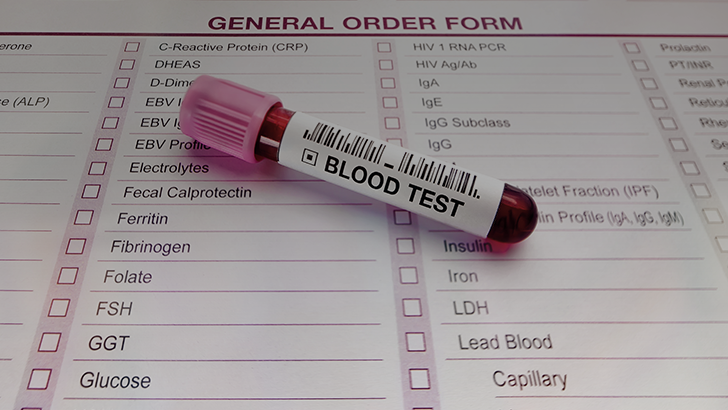 CME: marker, ursodiol, PBC, bilirubin, monitoring