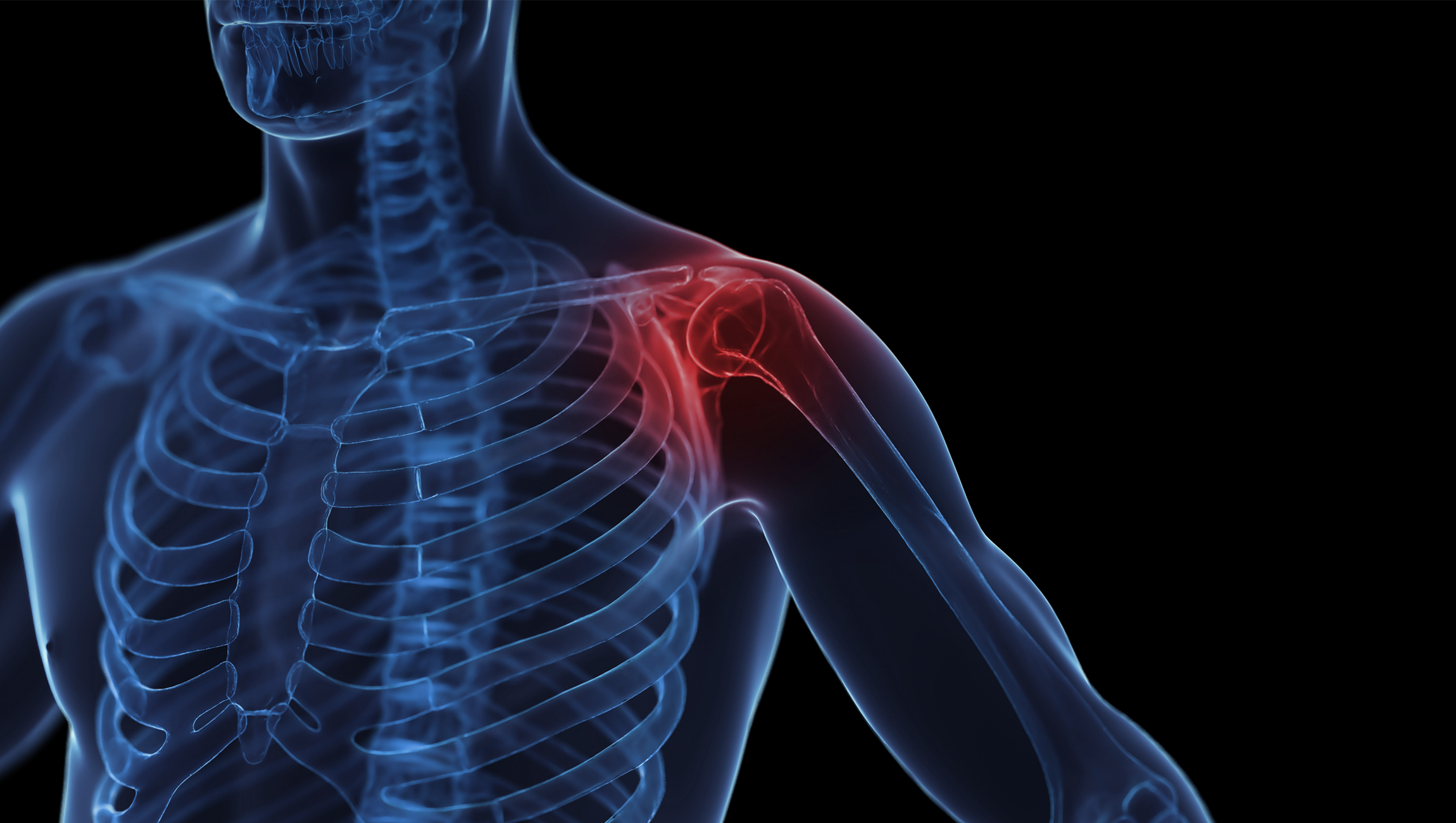 The Expanding Role of Peripheral Nerve Stimulation in Acute Pain ...