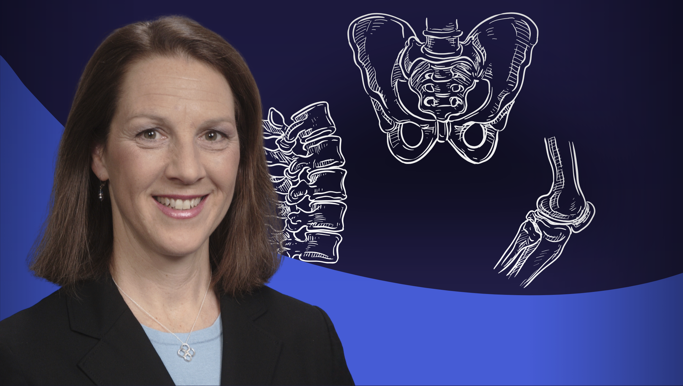 Optimizing Bone Health in Older Women: Exercise Strategies to Reduce ...