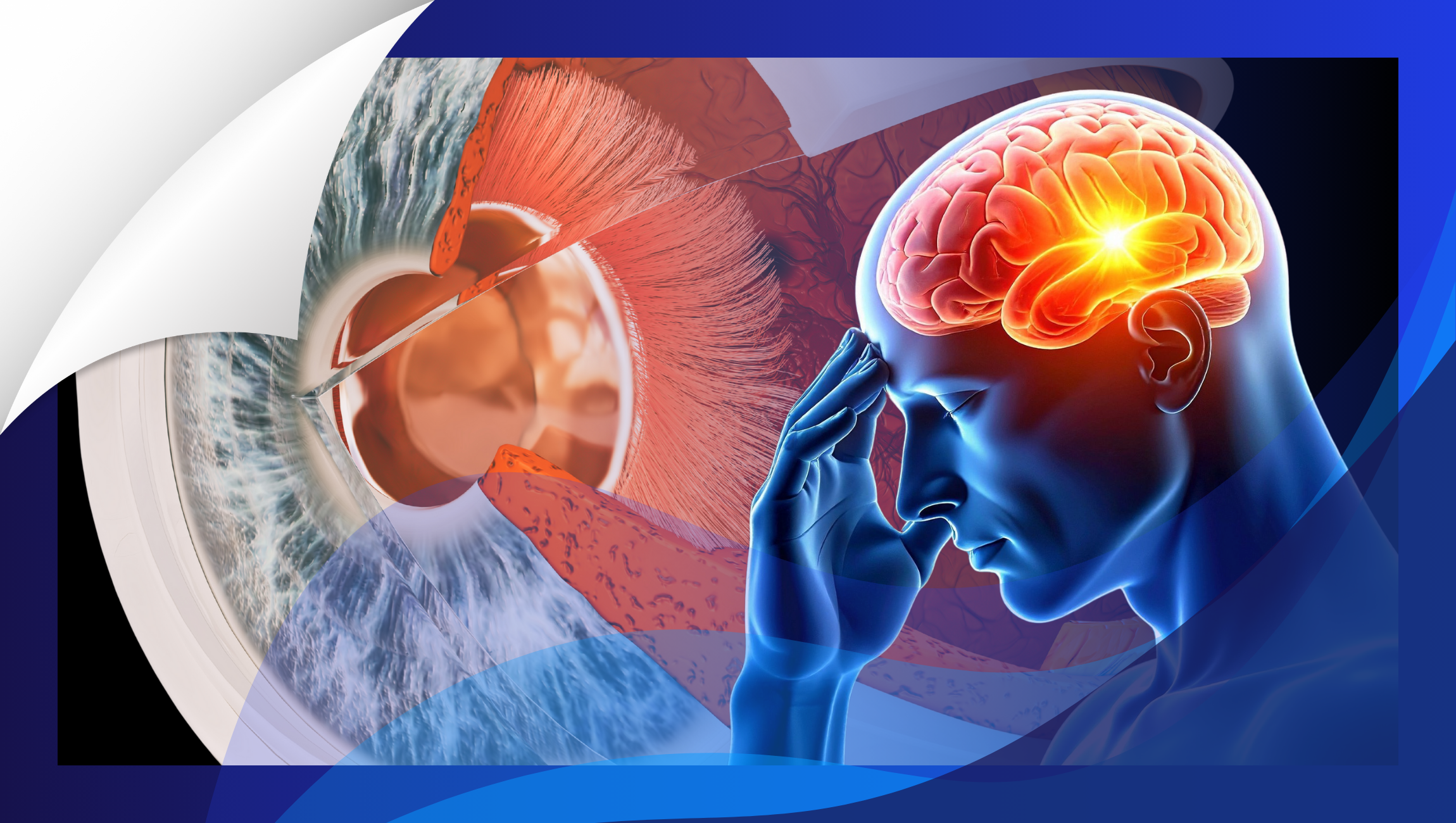 Retinal Vein Occlusion as a Predictor of Stroke