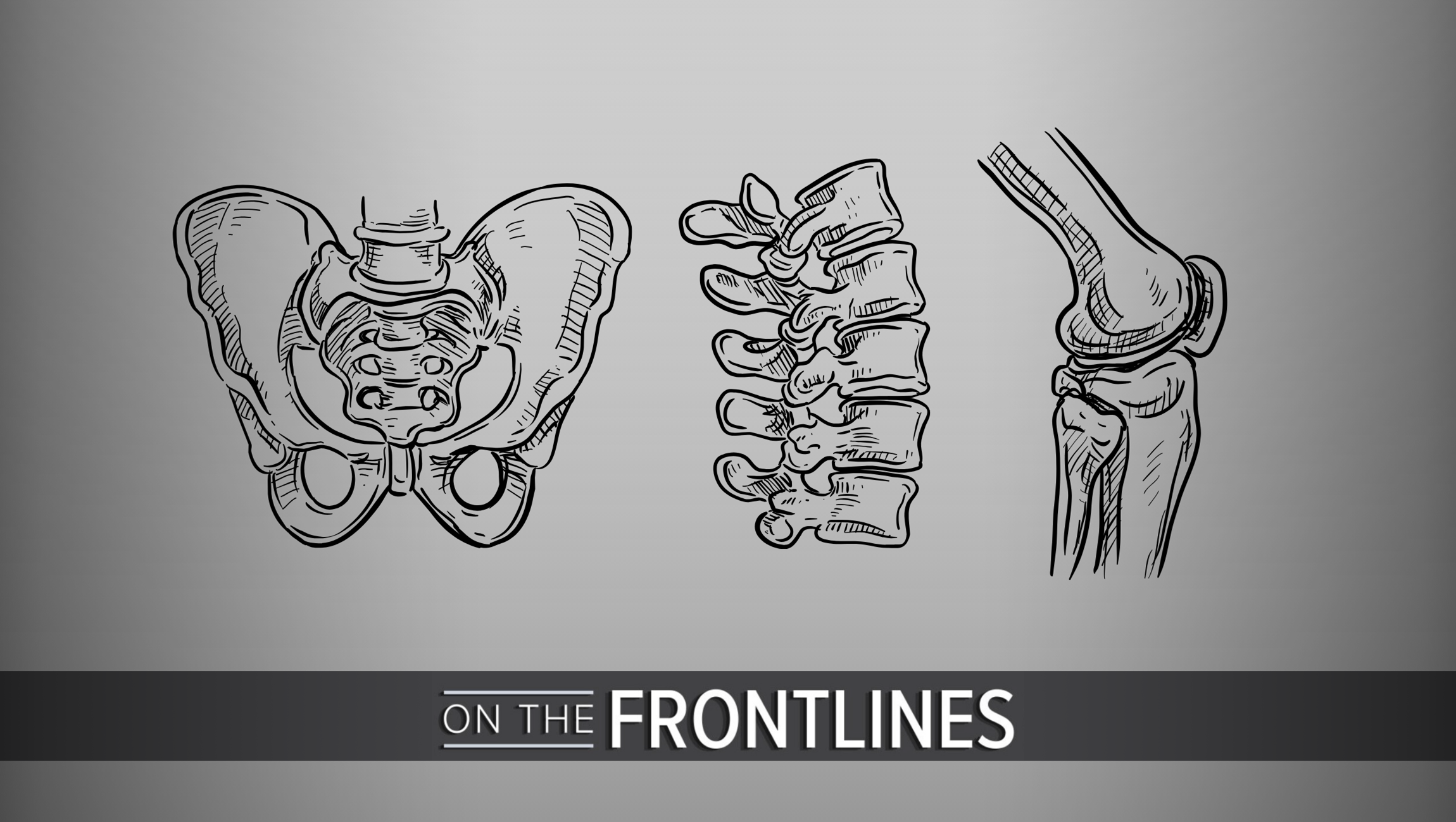 Preventing Osteoporosis with Hormone Therapy: How to Select Appropriate ...