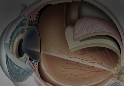 Technologies and Methods for Visualizing the Retina Medical Education ...
