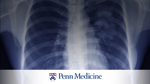A Thoracic Surgeon's Viewpoint on Screening, Diagnosis and Treatment of ...