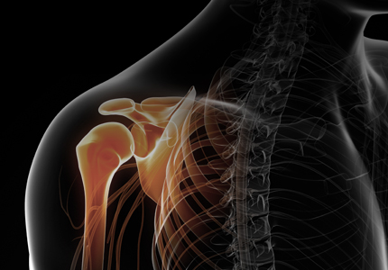 Best Approaches to Shoulder Injuries: From Orthopedics to Primary Care ...