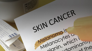 Medical Program: Melanoma Prevention Recommendations