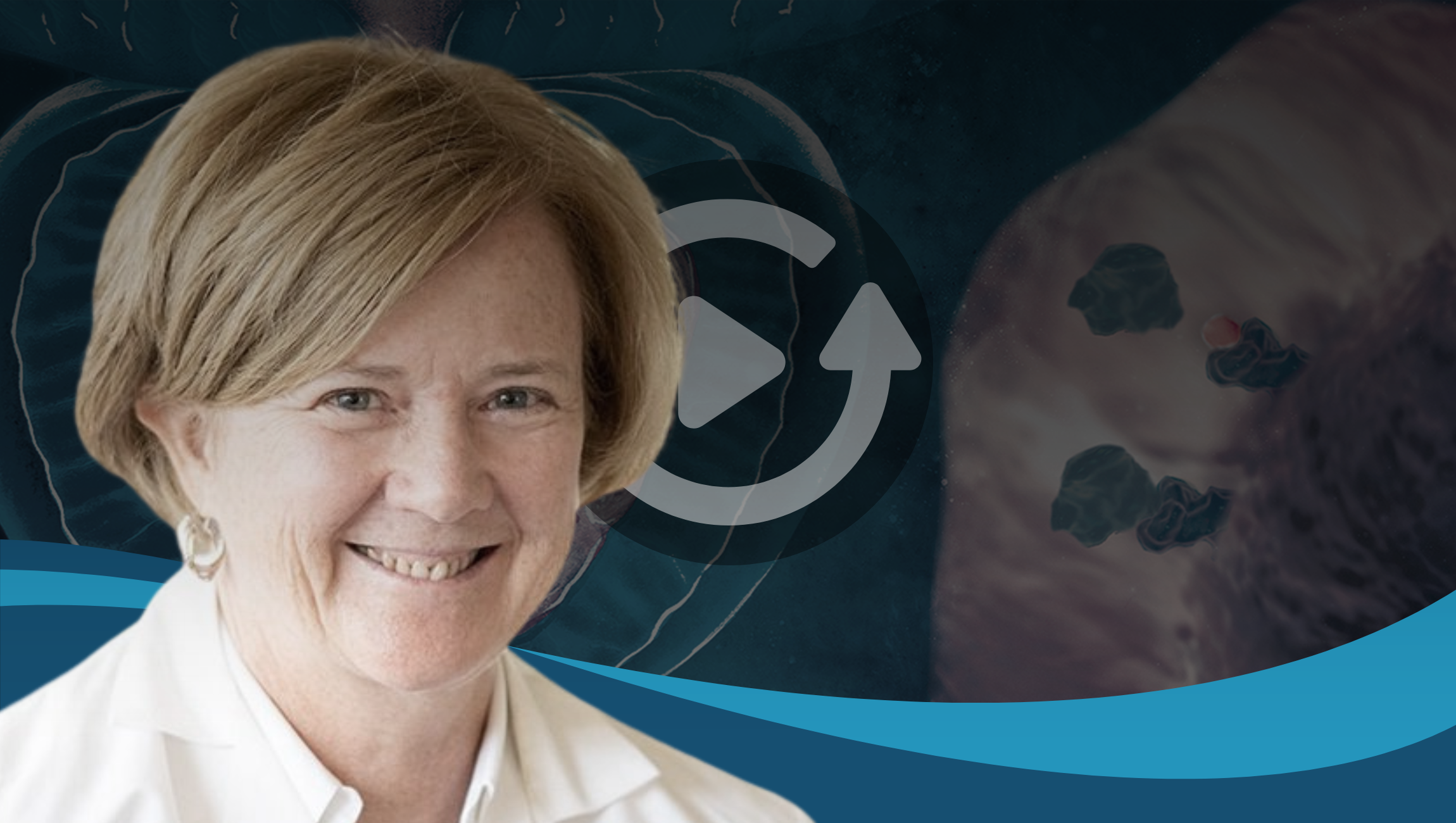 Patient-Centric ADT in Hormone-Sensitive Prostate Cancer