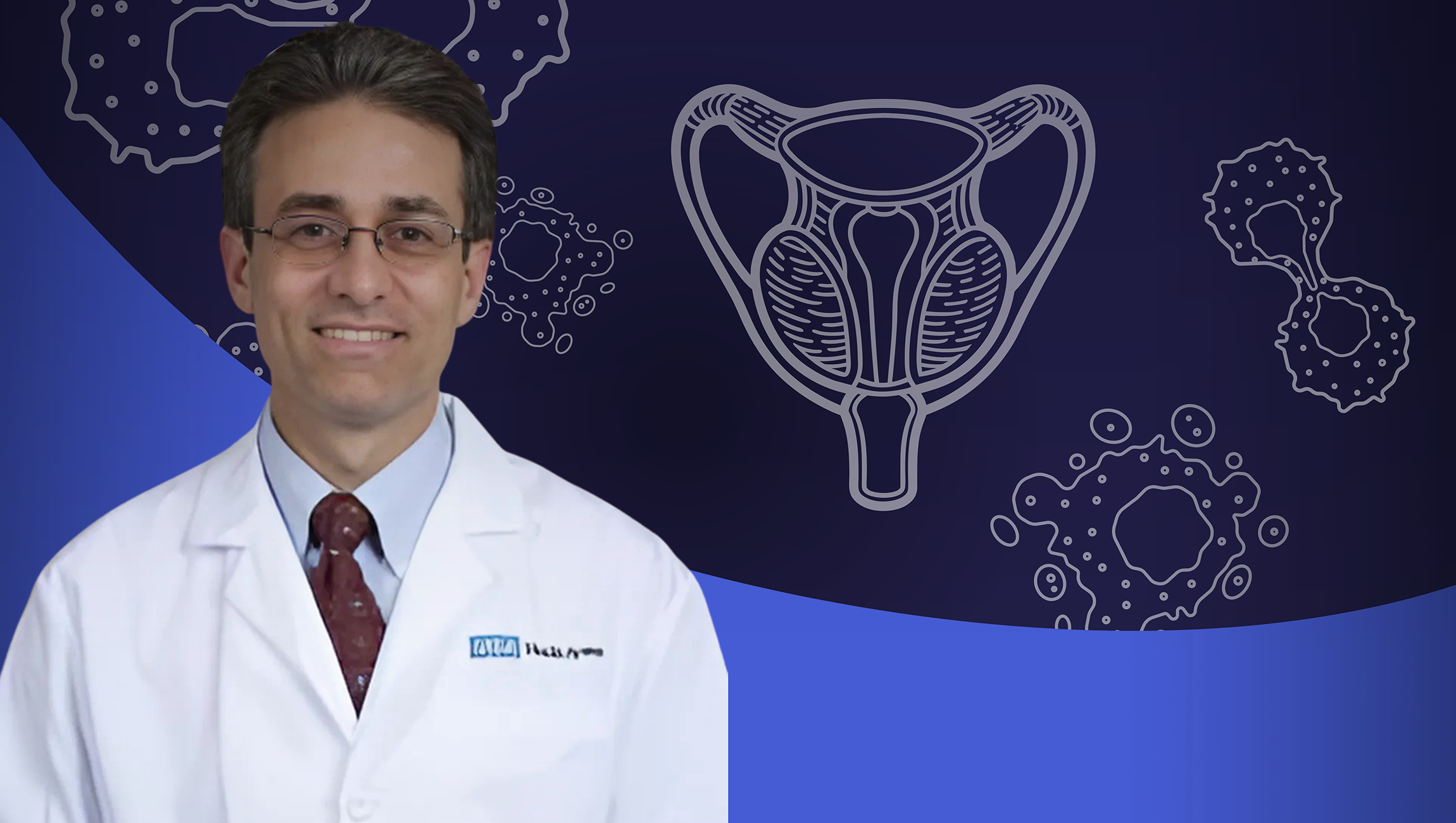Slowing Prostate Cancer Progression: The Role of Dietary Fat