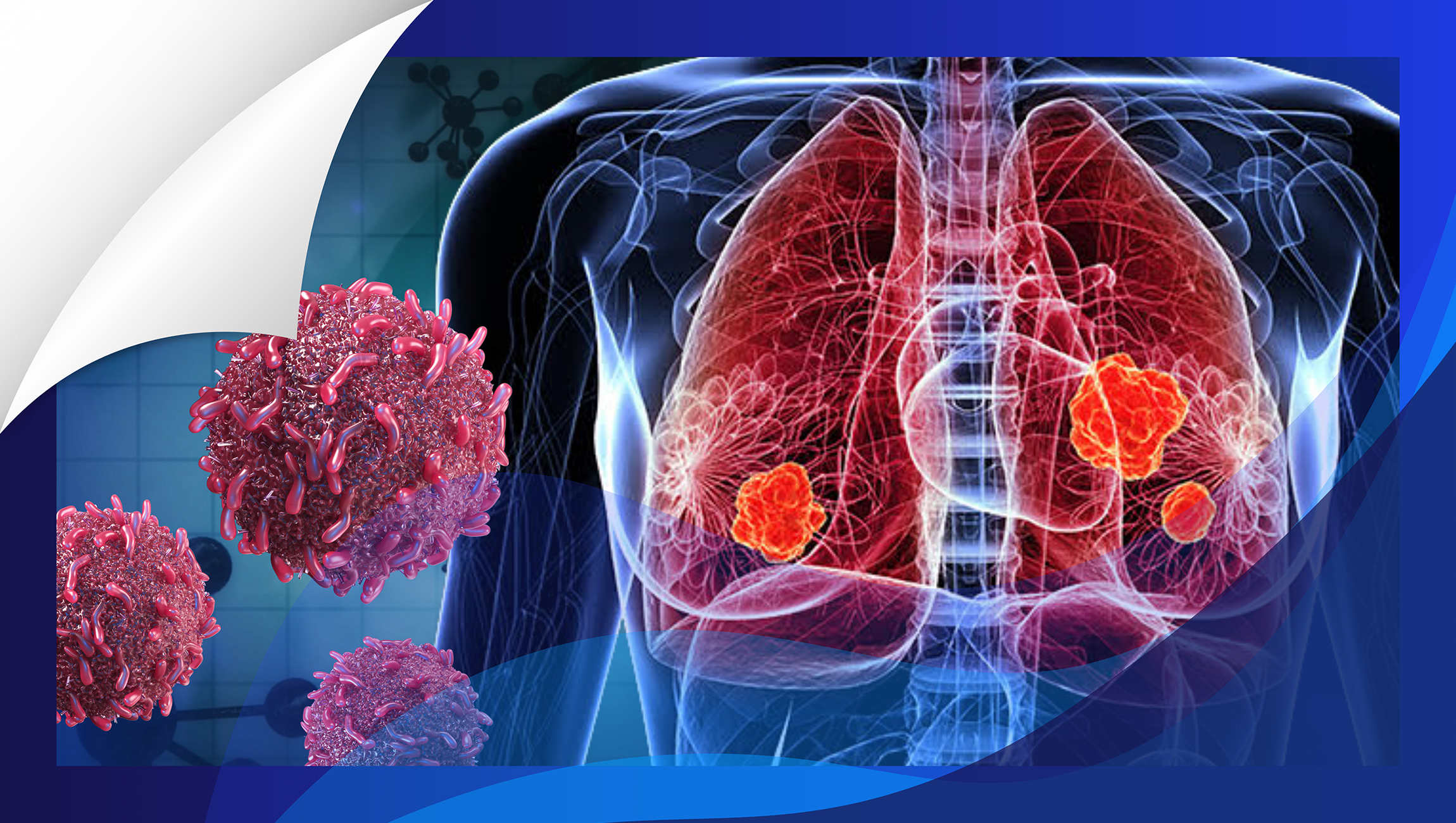 Mutational Complexity in ROS1-Positive mNSCLC: Insights from Real-World ...
