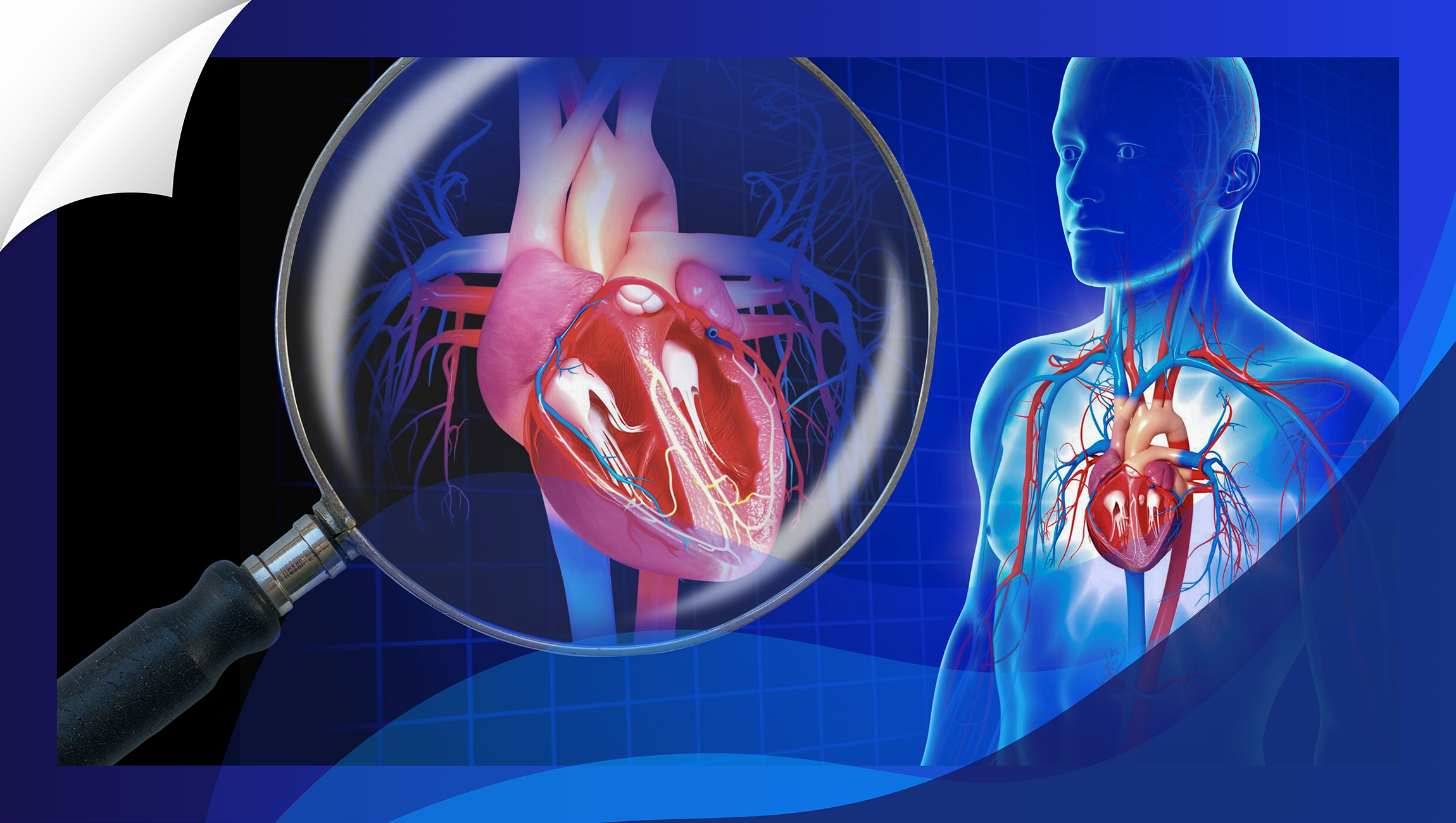 Understanding Diagnostic Gaps Among Medicare Patients with ATTRwt-CM ...